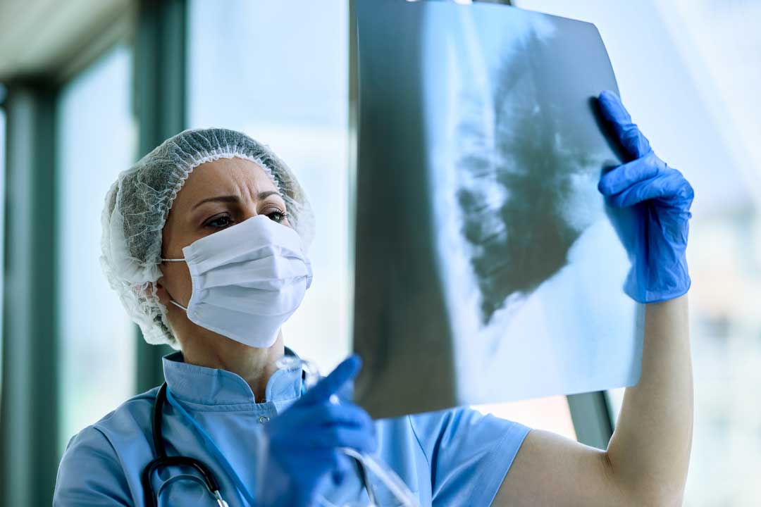 ¿Qué es la toracoscopia y para qué se utiliza? | EOC formación